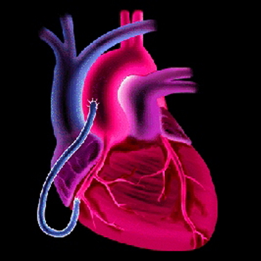 Transatlantic Heart Network