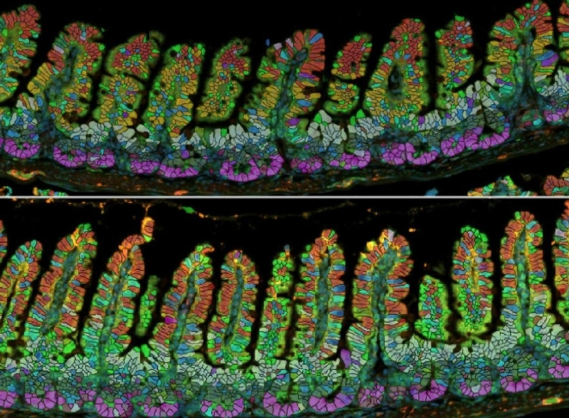 Pregnancy irreversibly remodels the mouse intestine