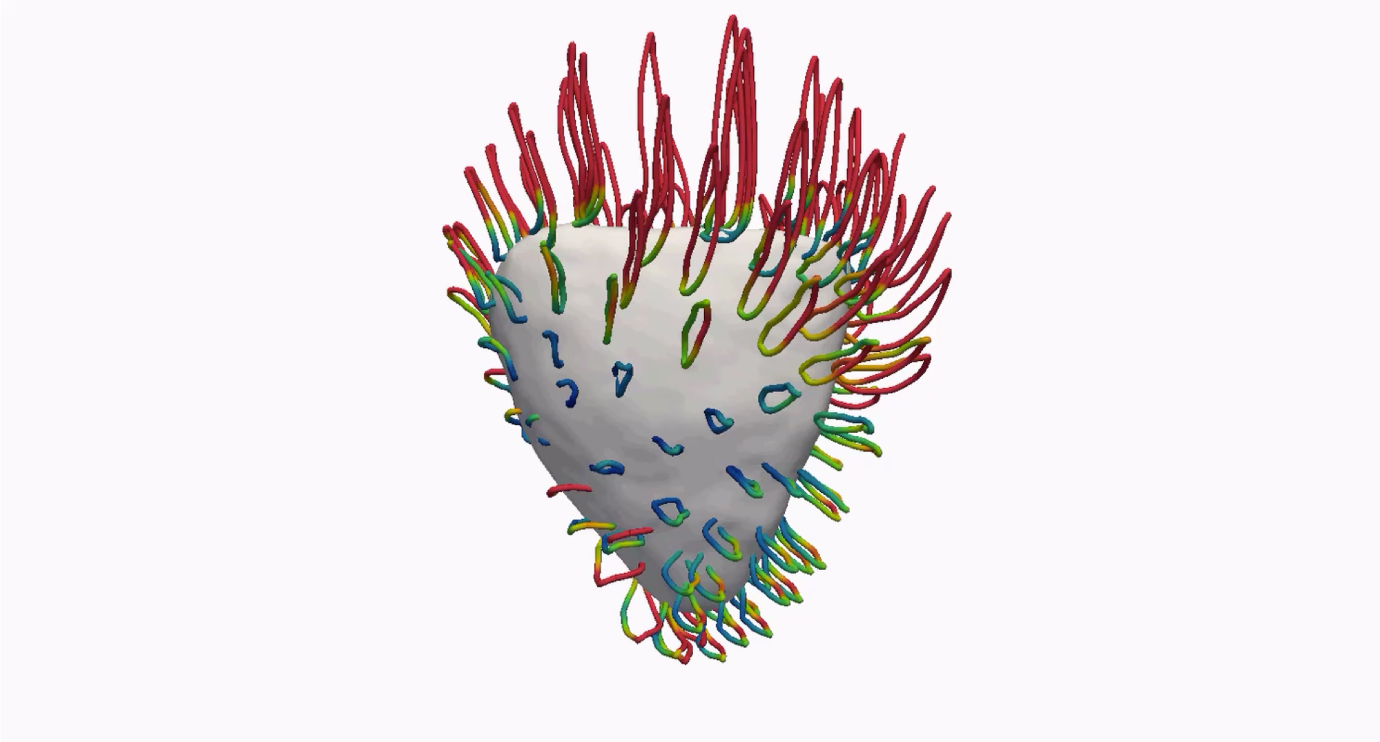 Don’t lose heart, it’s a promising future for AI in cardiac imaging
