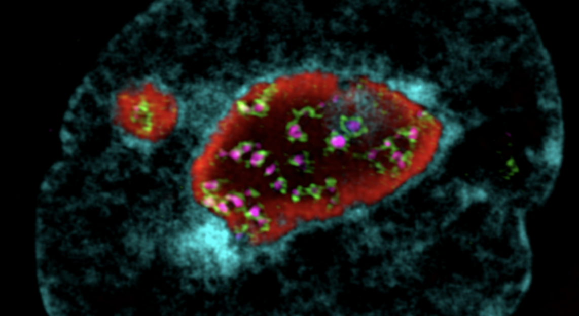 LMS researchers identify unexpected nucleolar mechanism for gene ...