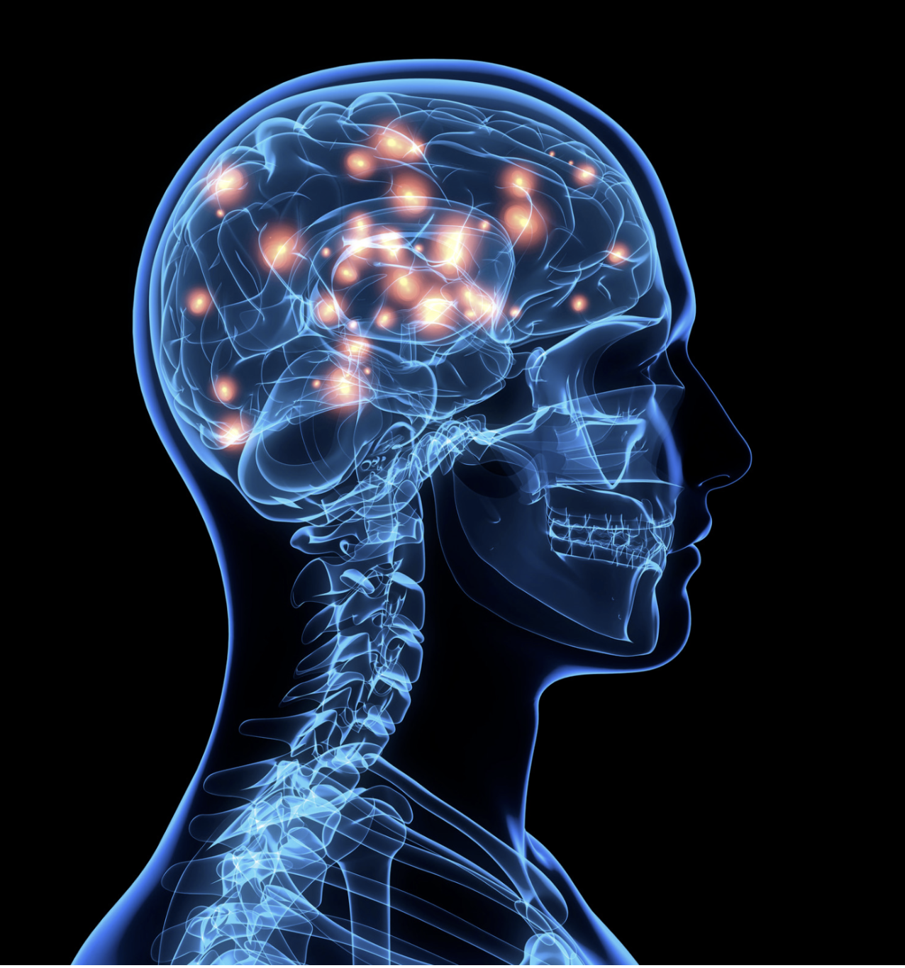 Development of a clinical prediction model for treatment-resistant ...