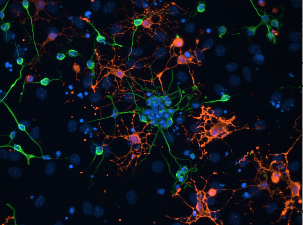 Brain Storm: New insight into how brain stem cells are born