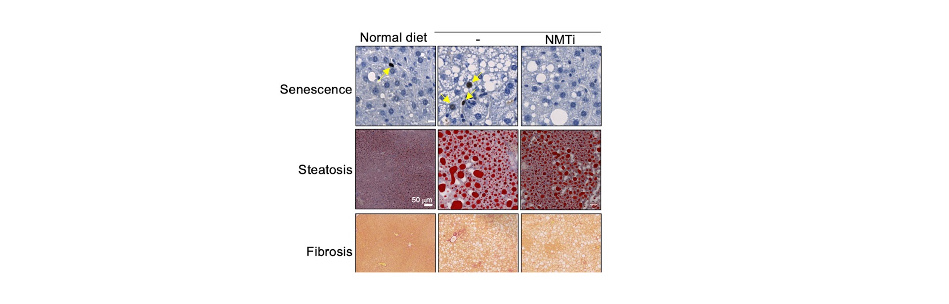 Unraveling the Secrets of Zombie cells: A new druggable pathway ...